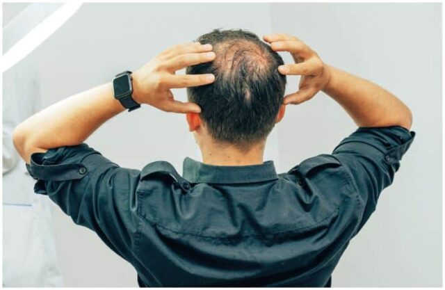 Hair Loss Spiritual Cause Meaning And Healing Insight State hair-loss-spiritual-cause-meaning-and-healing-insight-state