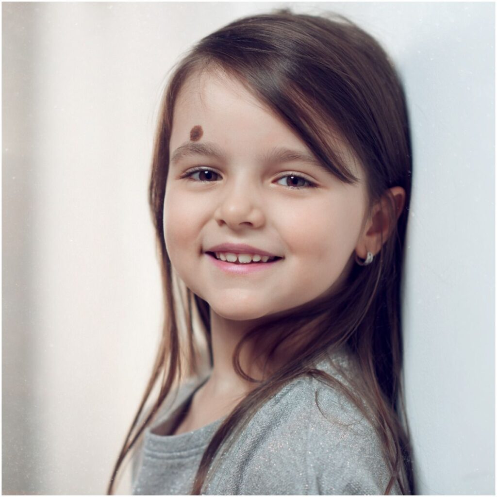 Birthmarks - Spiritual Meanings & Superstitions - Insight state