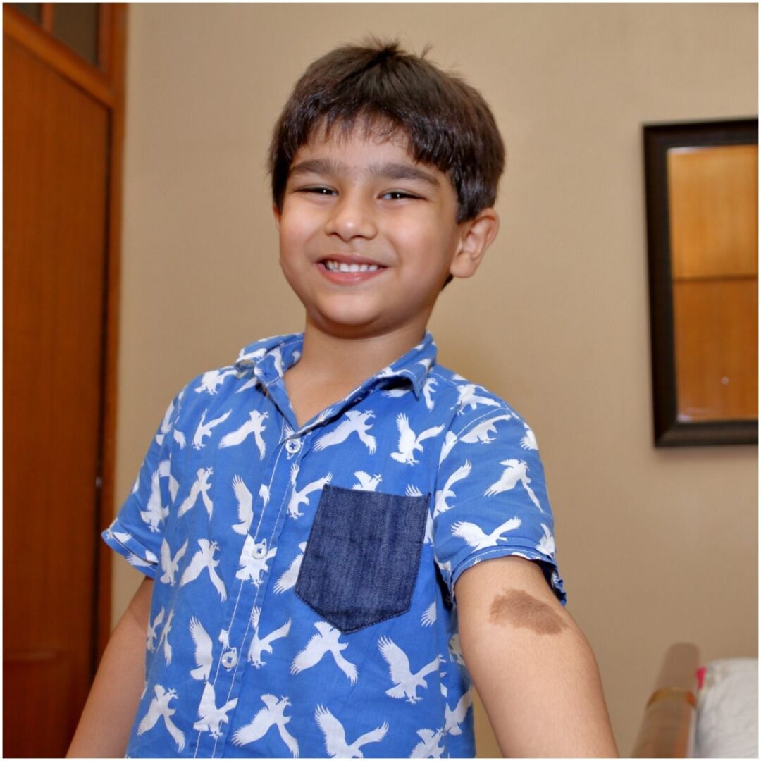 Birthmarks - Spiritual Meanings & Superstitions - Insight state