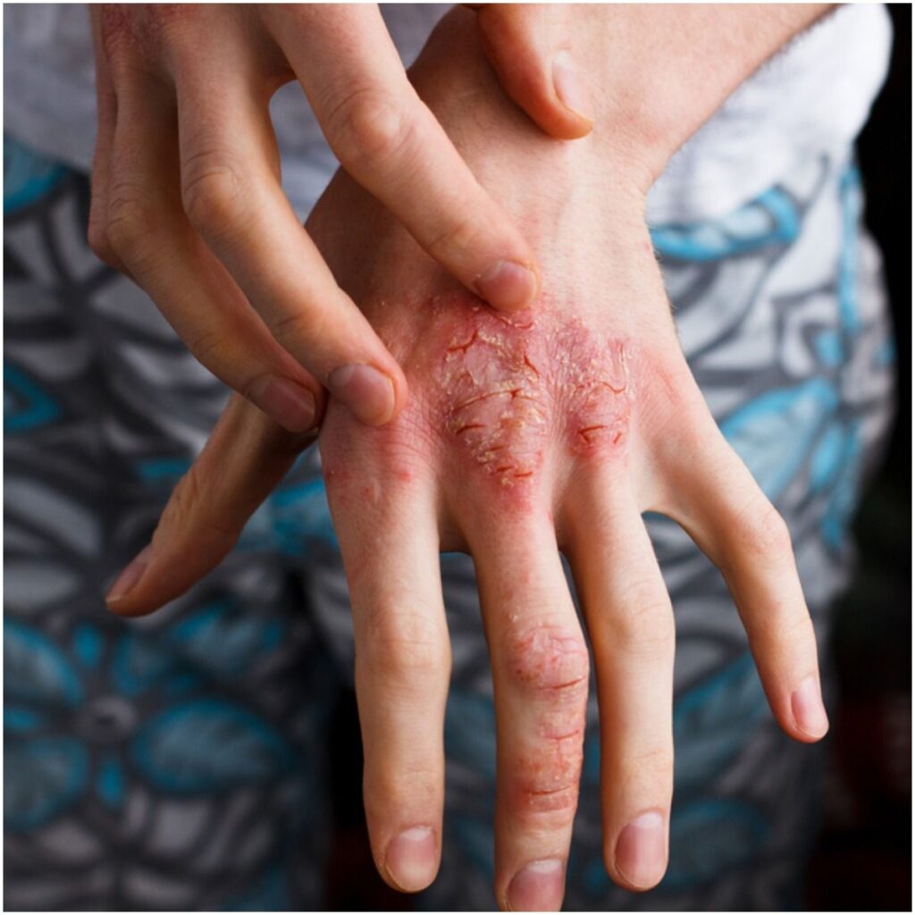 Spiritual Meaning of Itchy Skin (Chin, Left and Right Foot, Nose, Elbow ...