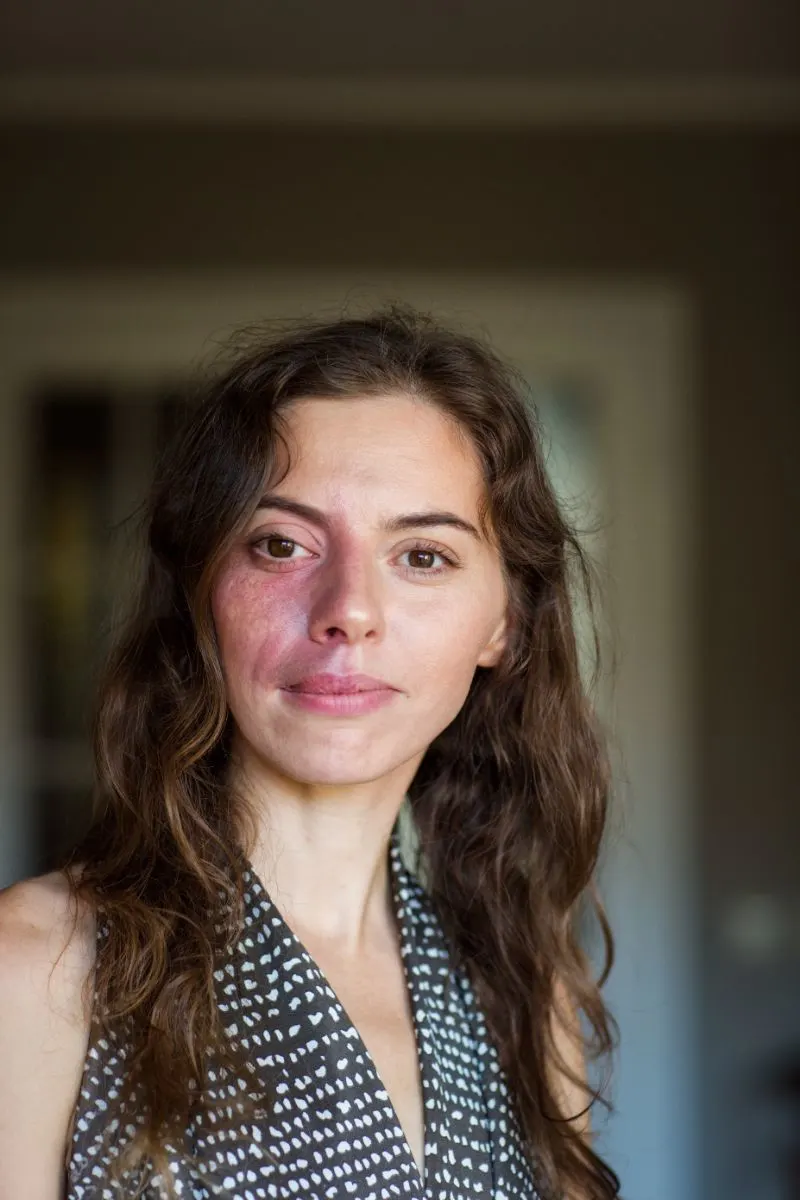 Birthmarks - Spiritual Meanings & Superstitions - Insight state